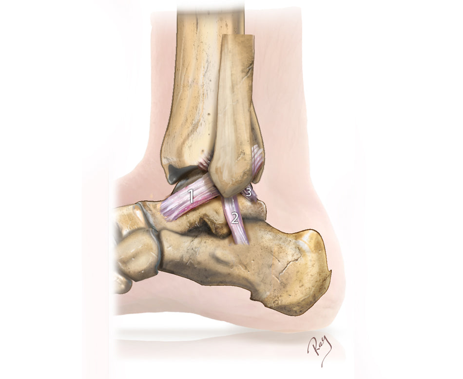 Ankle sprain – Dr. Laurent Goubau